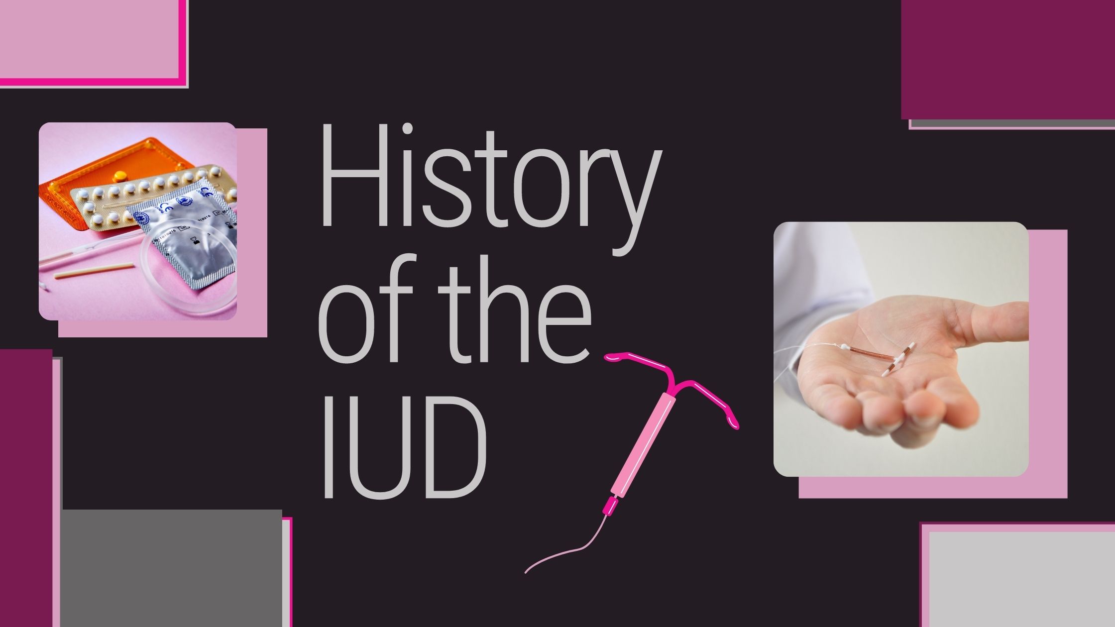 Historical Iud Shapes